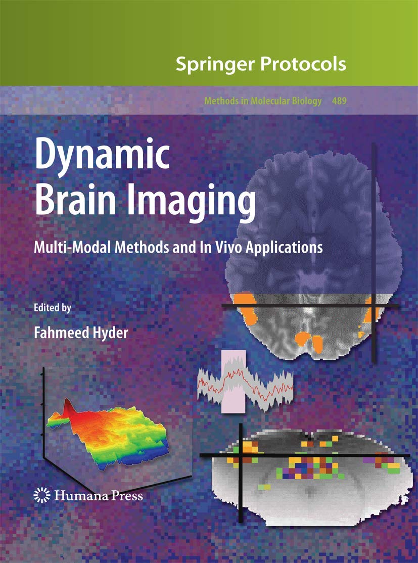 Dynamic Brain Imaging: Multi-Modal Methods and In Vivo Applications ...