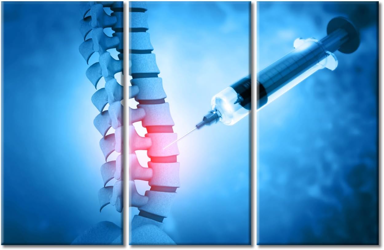 Amazon.com: Severe Pain in the Spine and Intervertebral Discs Pictures ...