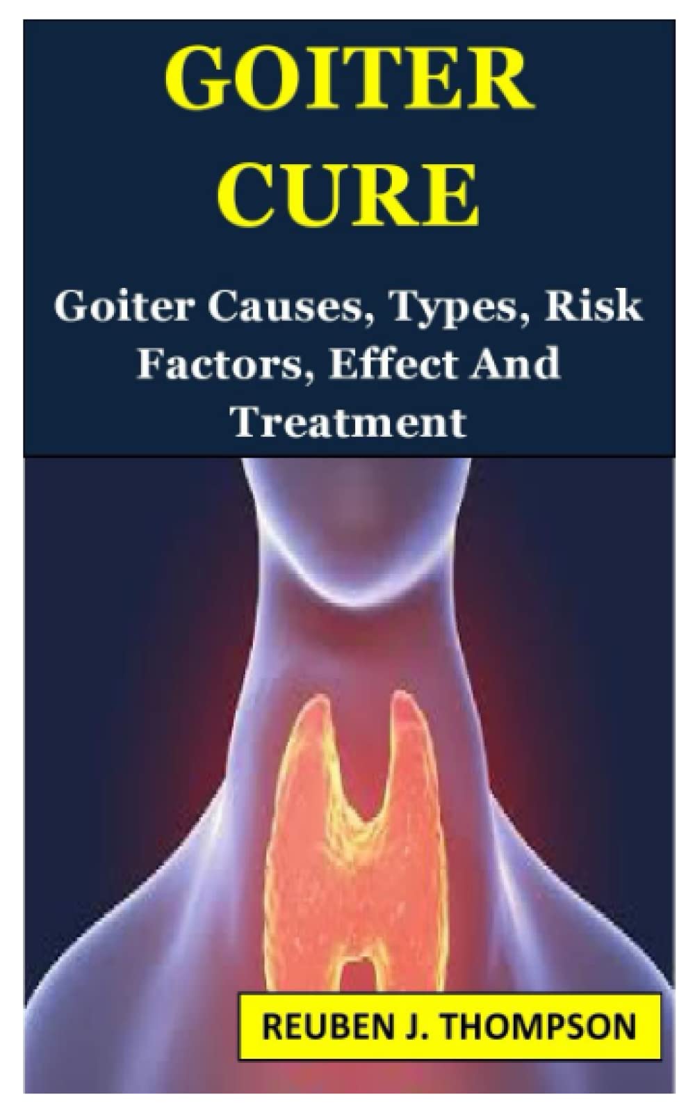 Buy GOITER CURE: Goiter Causes, Types, Risk Factors, Effect And Online ...