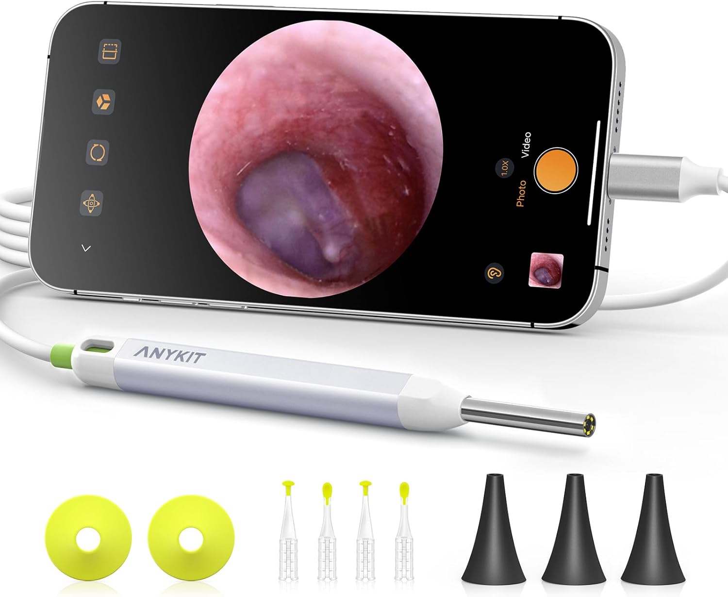 Amazon.com: Anykit Digital Otoscope with Gyroscope, HD Ultra Clear View ...