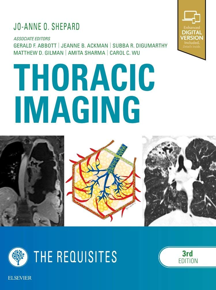 Thoracic Imaging The Requisites (Requisites in Radiology ...
