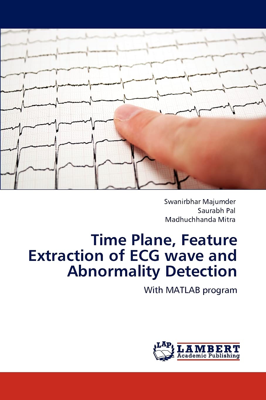 Buy Time Plane Feature Extraction Of Ecg Wave And Abnormality