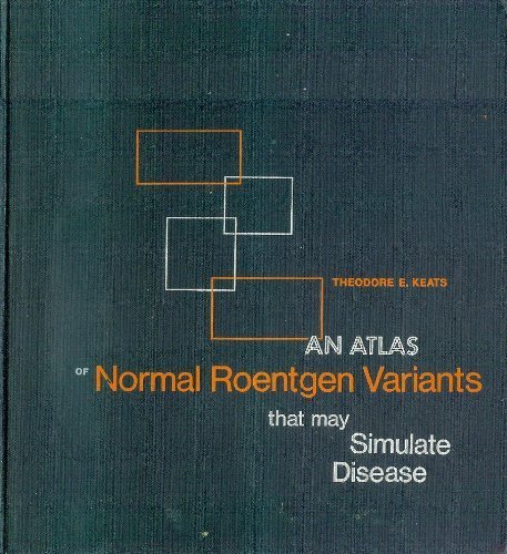 Amazon | Atlas of Normal Roentgen Variants That May Simulate Disease ...