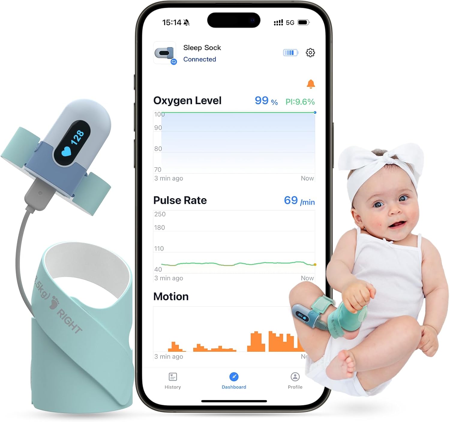 Babytone Baby Pulse Oximeter, Smart Baby Sock Tracking Oxygen Level ...