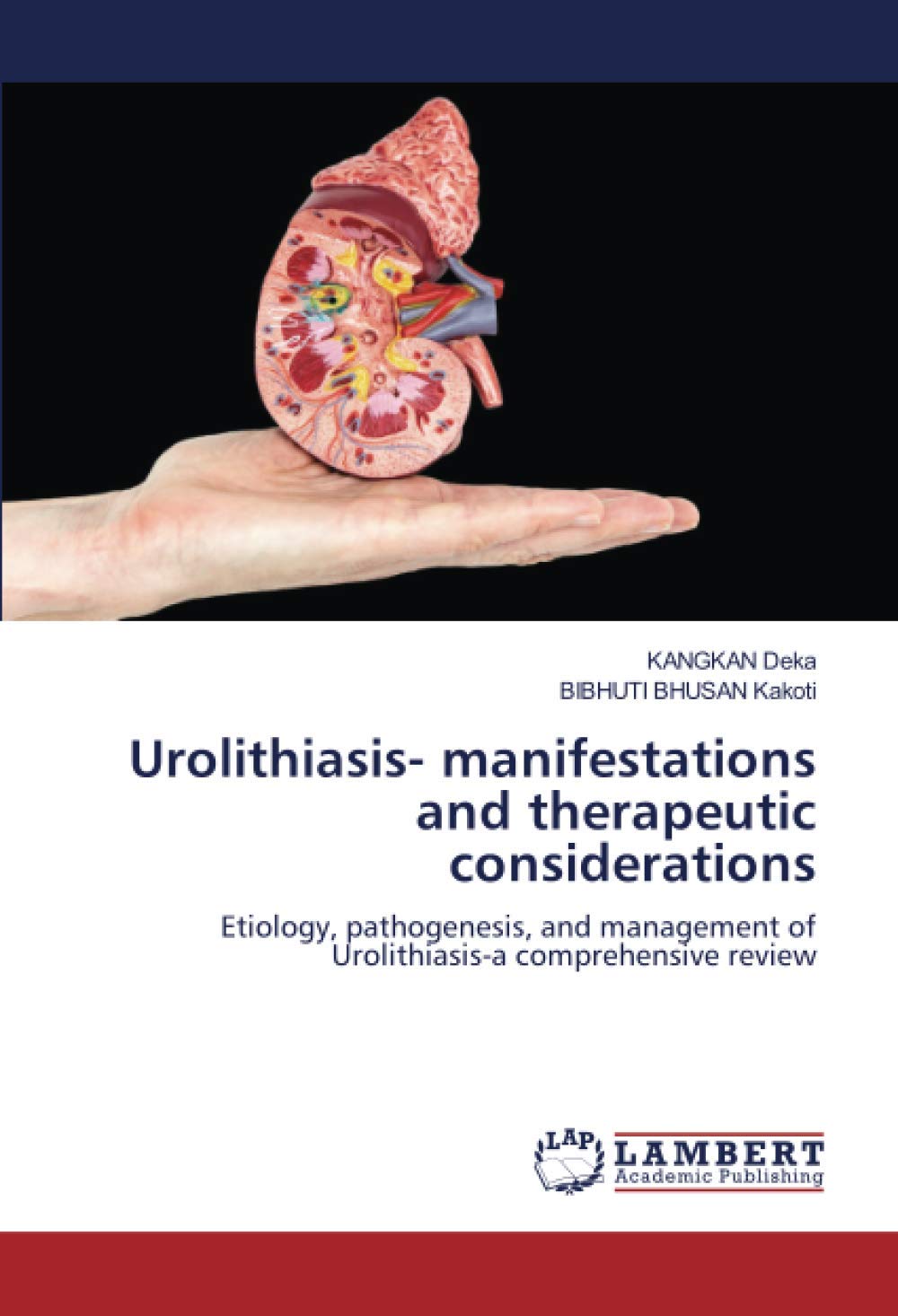 Buy Urolithiasis- manifestations and therapeutic considerations ...