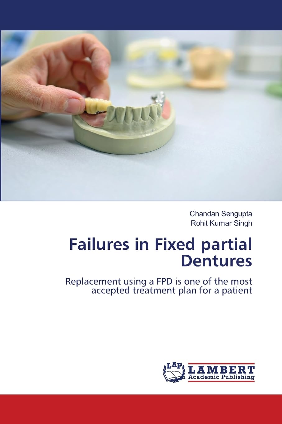 Buy Failures in Fixed partial Dentures Book Online at Low Prices in ...