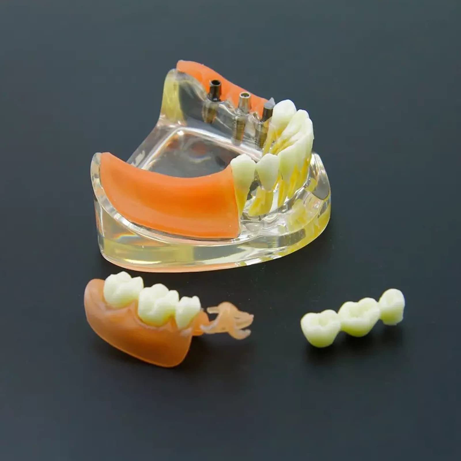 Buy Dental Model Dental Oral Teaching Model, Demo Model Of Removable ...
