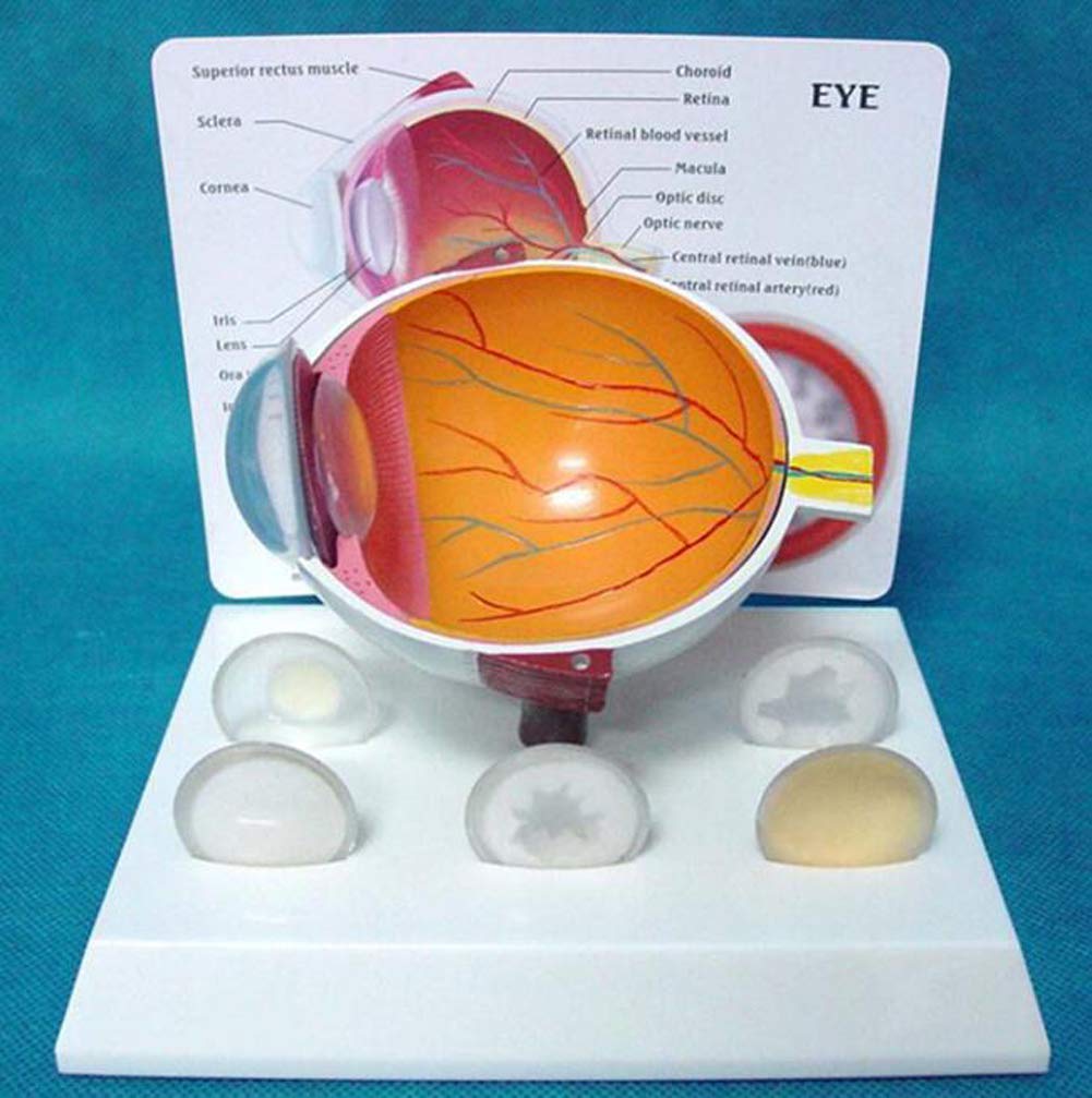 Buy Educational Model Model Anatomies Human Eyeball Eye Injury Eye ...
