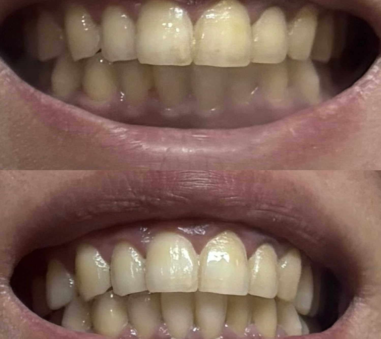 Amazon.co.jp: Settima Whitening Toothpaste, Special Care 2-3 Times per ...