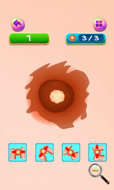 Pimples and Blackheads Removal : get rid of pimples from nose and face ...