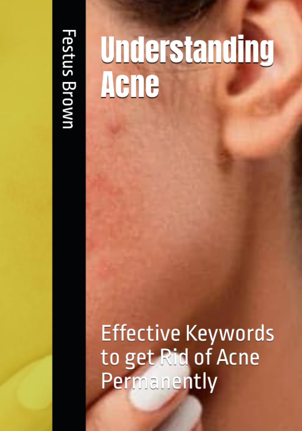 Understanding Acne: Effective Keywords to get Rid of Acne Permanently: Brown, Festus, Brown ...