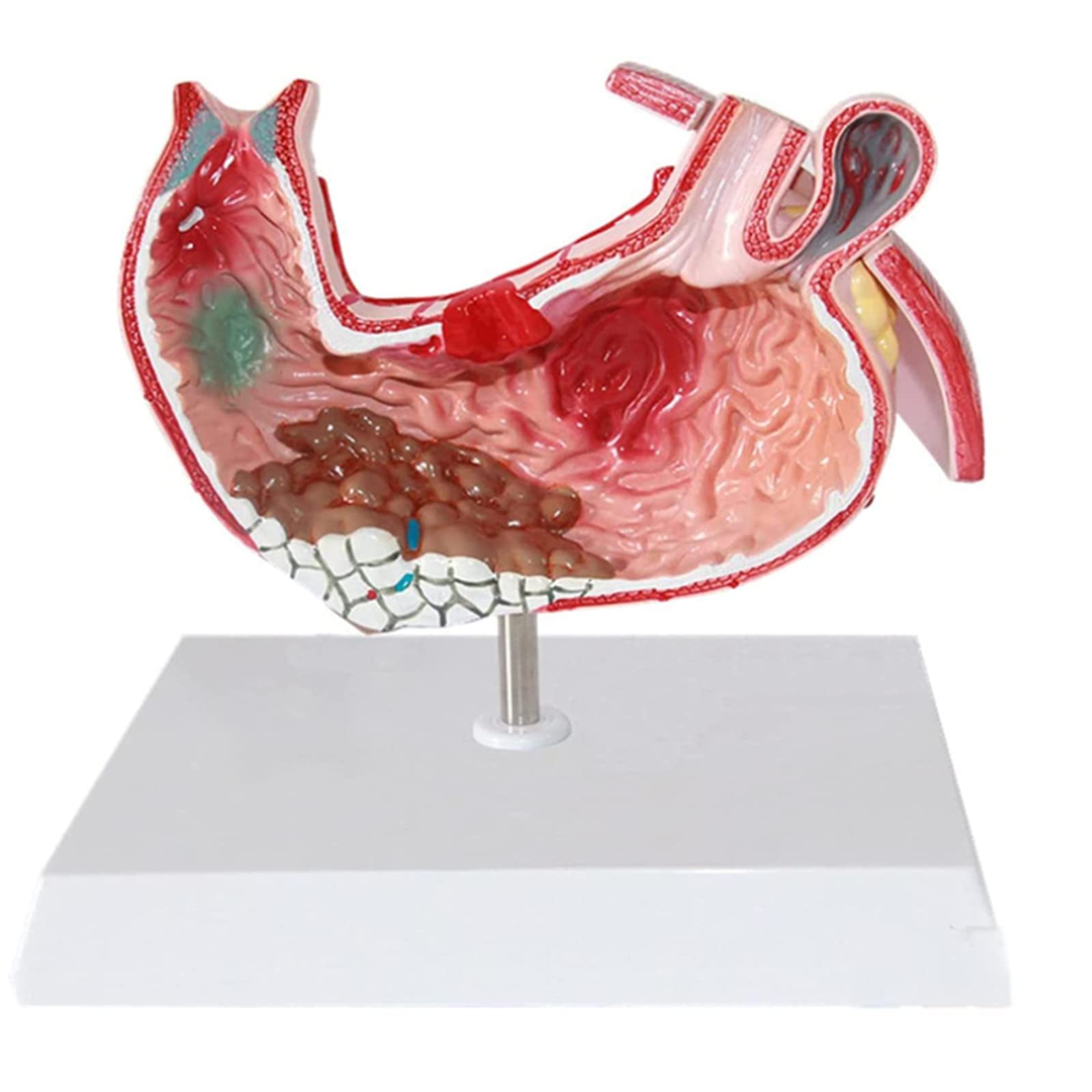 Xhllx Human Digestive System Model Stomach Anatomical Model Digestive ...