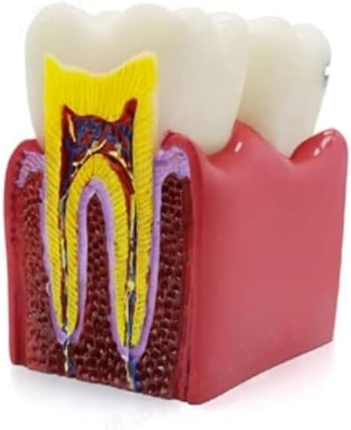 Amazon.com: 6 Times Dental Teeth Model Tooth Props Caries For Teaching ...