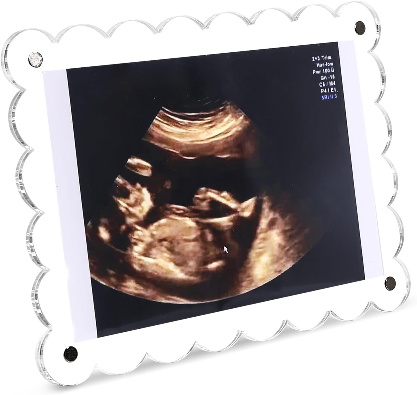 Amazon.com: Kate & Milo You Are So Loved Shadowbox Frame, Newborn ...