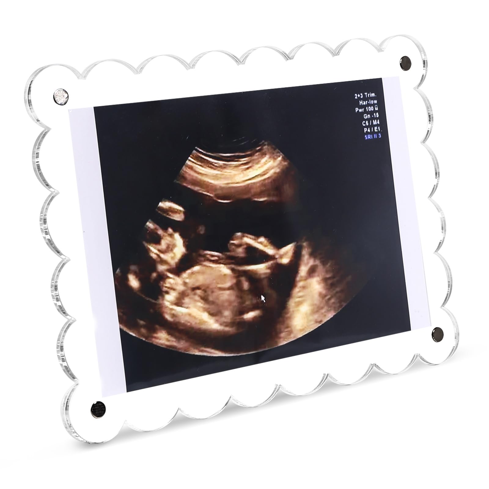 Amazon.com: Magnetic Clear Acrylic Scalloped Baby Ultrasound Picture ...