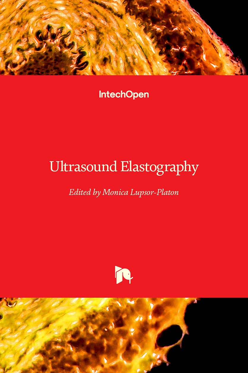 Ultrasound Elastography: Lupsor-Platon, Monica: 9781789857092: Amazon ...