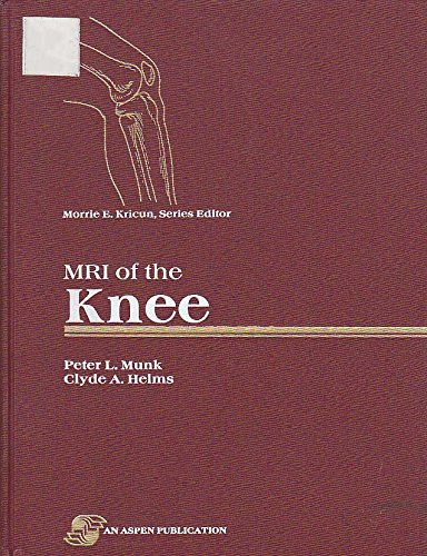 MRI of the Knee (Clinical Diagnosis Imaging): 9780834202467: Medicine ...