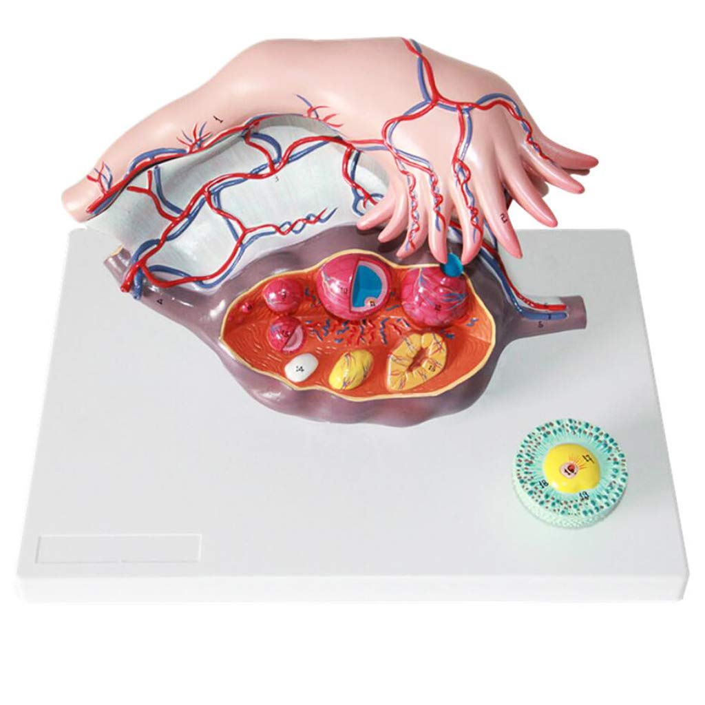 Luckfy Uterine Anatomy Model Ovarian Enlargement Model Skin And ...