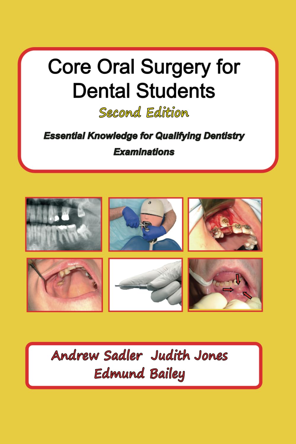 Core Oral Surgery for Dental Students Second Edition: Essential ...