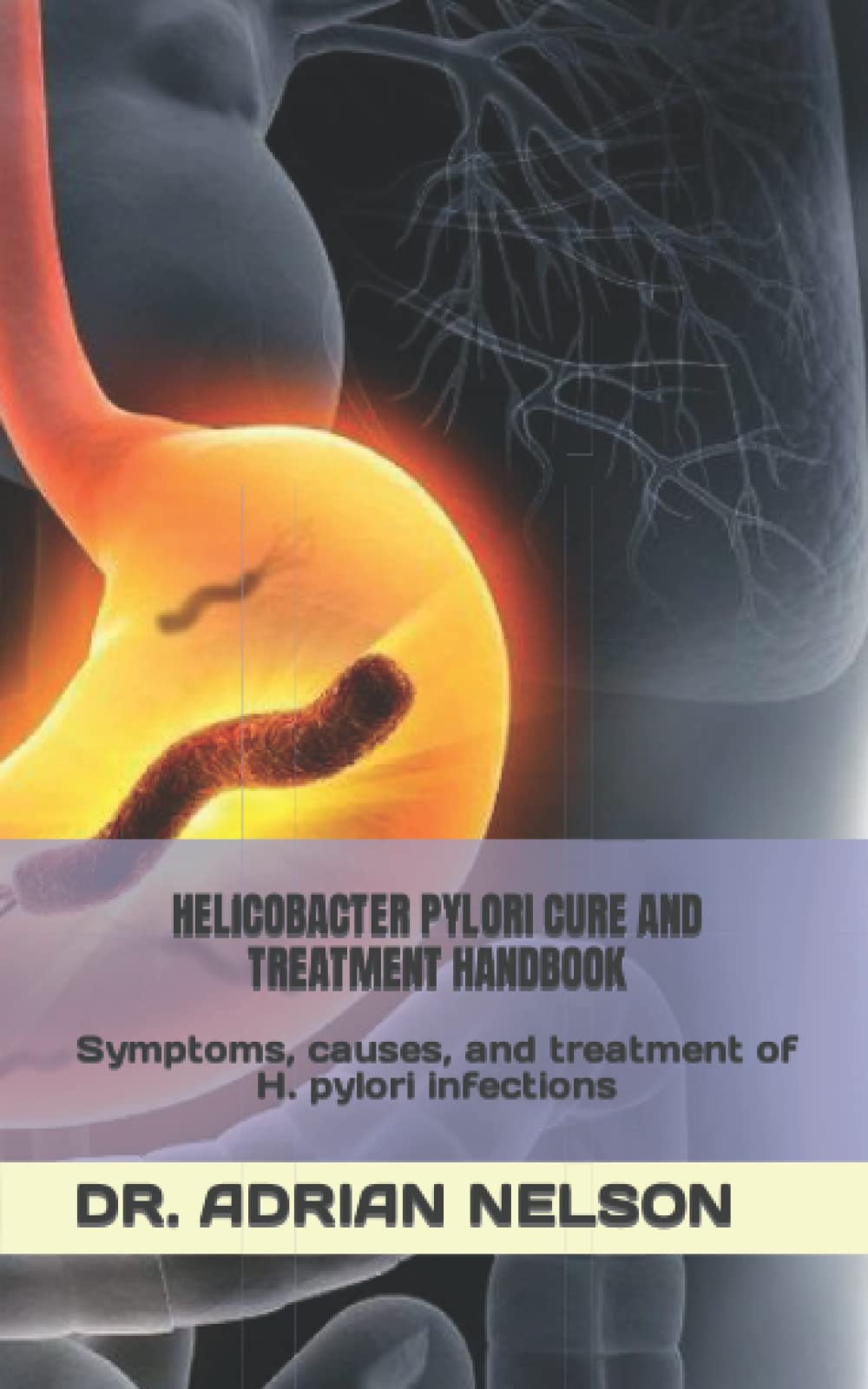 Buy HELICOBACTER PYLORI CURE AND HANDBOOK: Symptoms, causes, and of H ...
