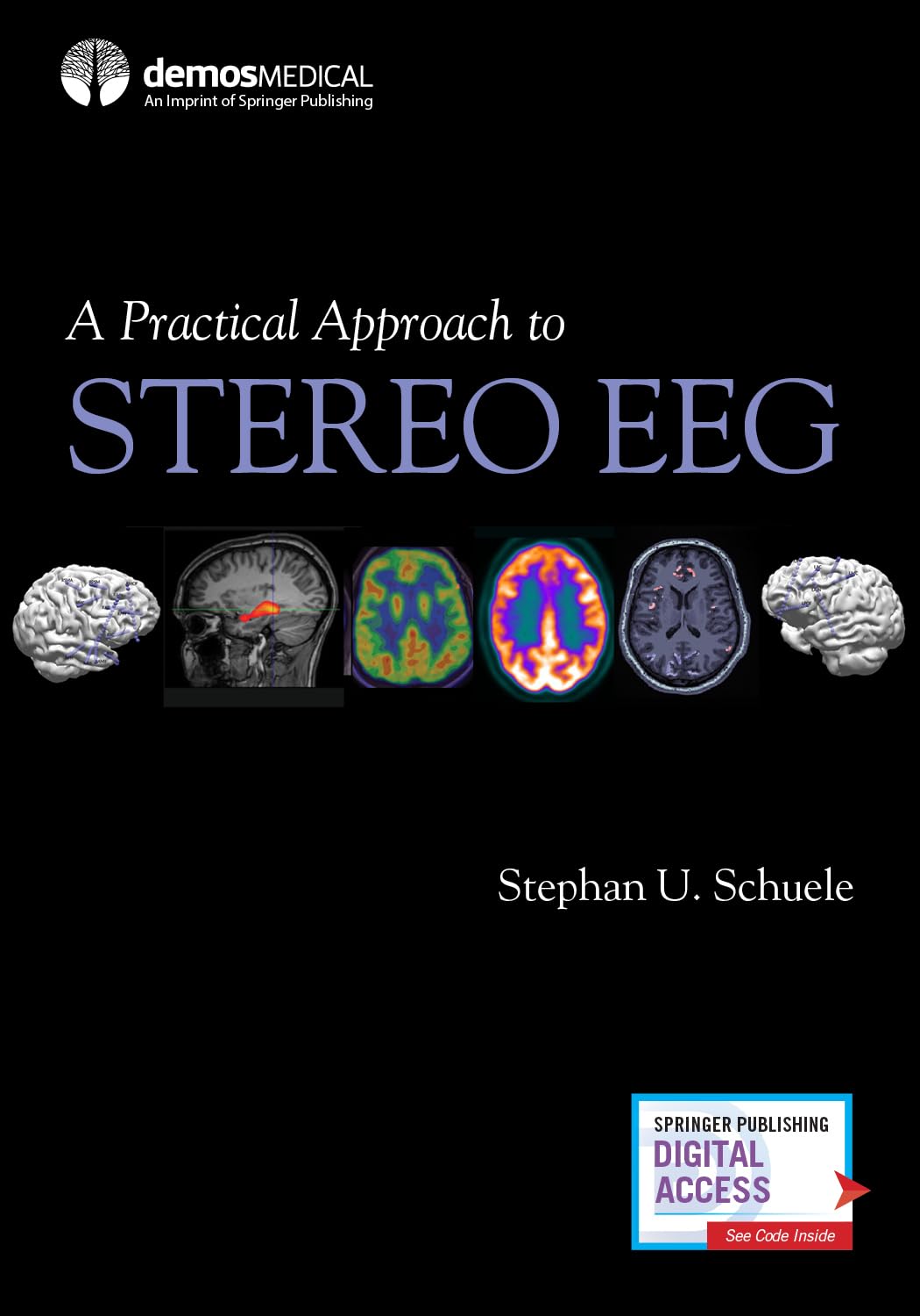 A Practical Approach to Stereo EEG: 9780826136923: Medicine & Health ...