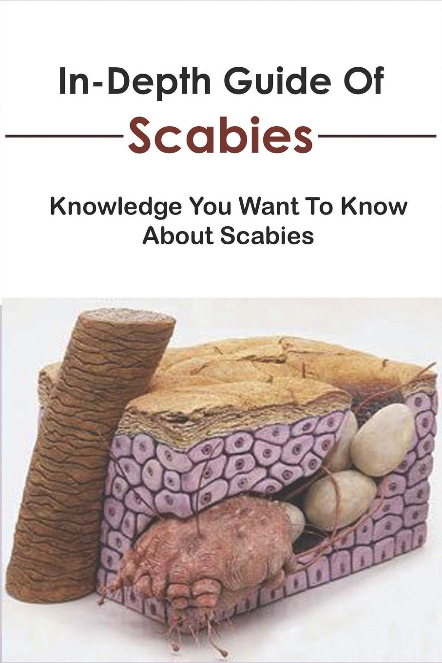 In Depth Guide Of Scabies Knowledge You Want To Know | Desertcart EGYPT