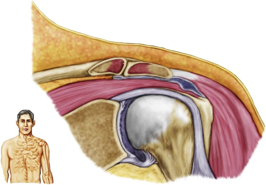Amazon.com: Posterazzi Anatomy of left shoulder coronal view Poster ...