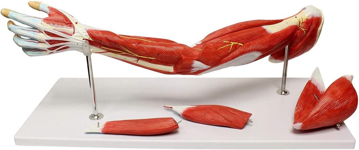 UIGJIOG Life Size Muscled Arm Model 7 Parts Anatomical Left Arm Model ...