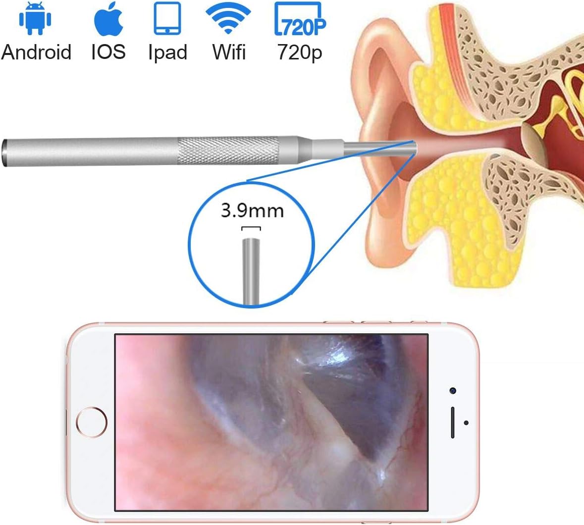 Amazon.com: Dakoliving Super Slim 3.9mm Ear Scope with Light, Digital ...