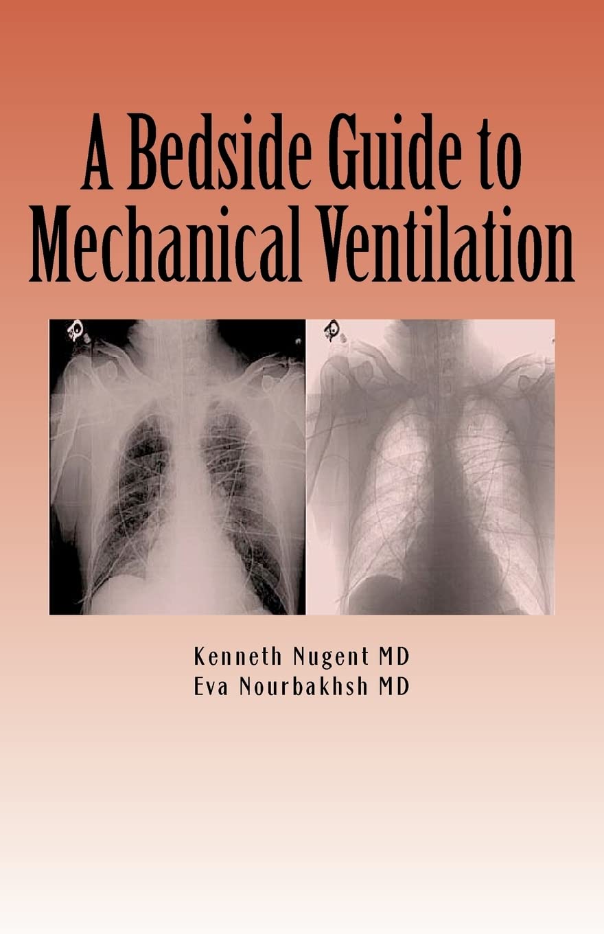 A Bedside Guide to Mechanical Ventilation: Amazon.co.uk: Nugent MD ...