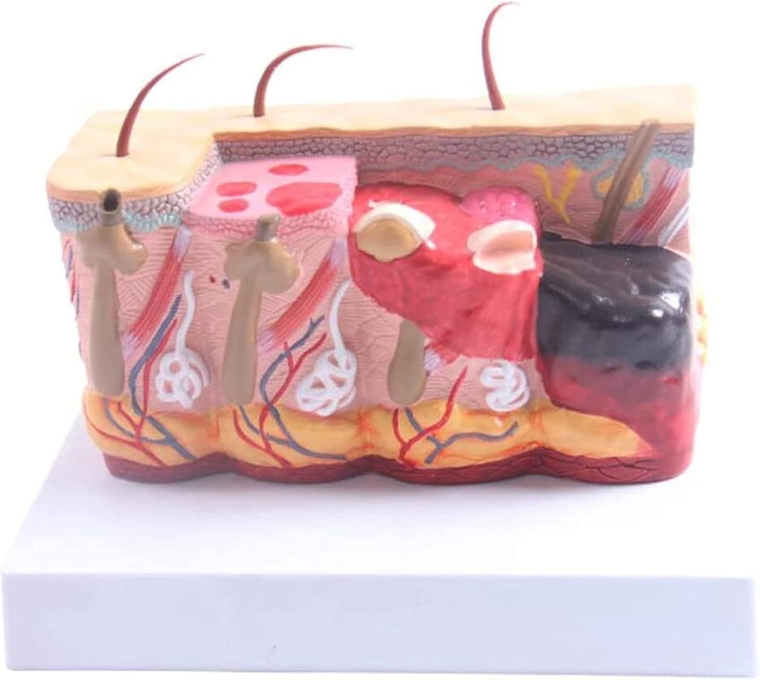 Amazon.com: Skin Anatomical Model Human Burn Skin Anatomy Model Medical ...