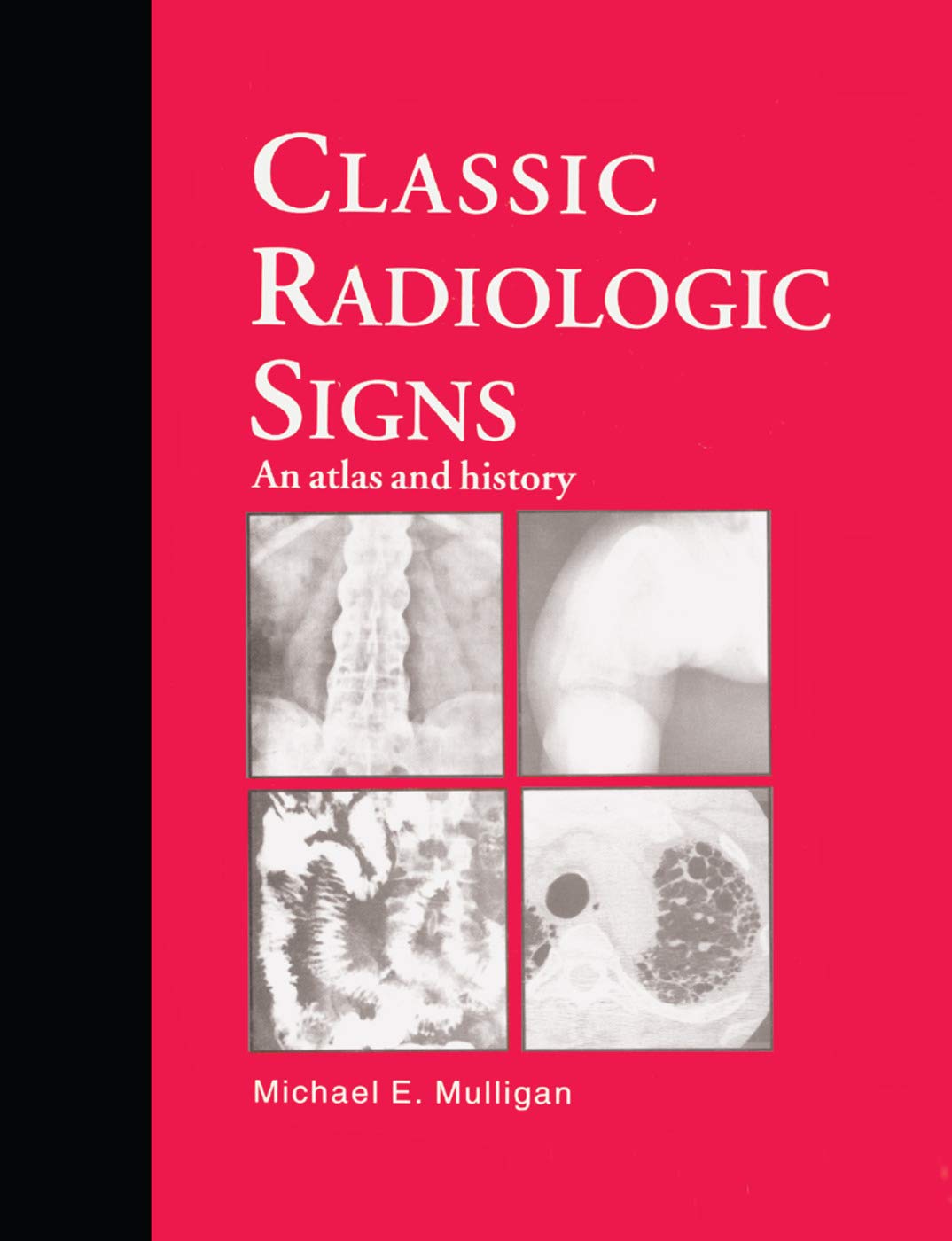 Classic Radiologic Signs: An Atlas and History: 9780367401153: Medicine ...