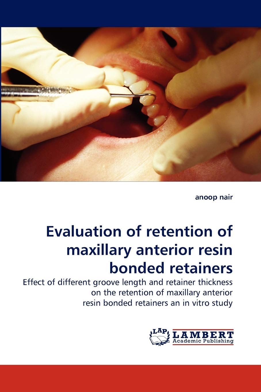 Buy Evaluation of retention of maxillary anterior resin bonded ...