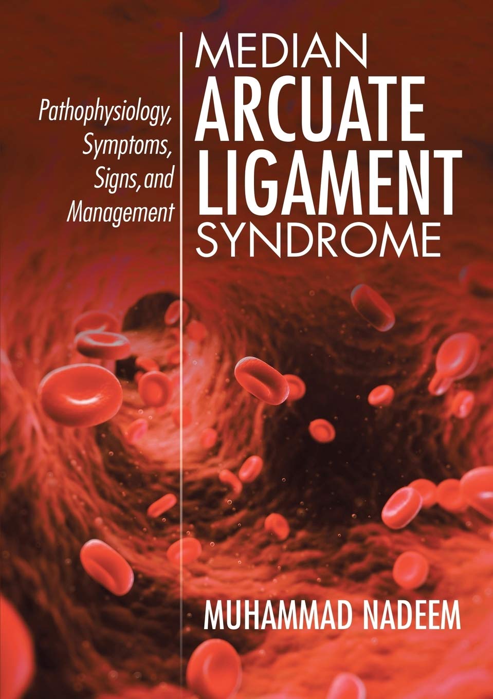 Buy Median Arcuate Ligament Syndrome: Pathophysiology, Symptoms, Signs ...