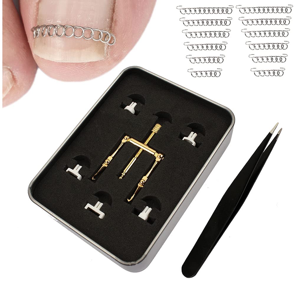 Amazon.com: Ingrown Toenail Tools Kit Includes Ingrown Toenail Tool Toe ...