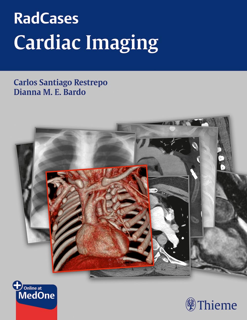 Radcases Cardiac Imaging (Radcases Plus Q&A): 9781604061857: Medicine ...