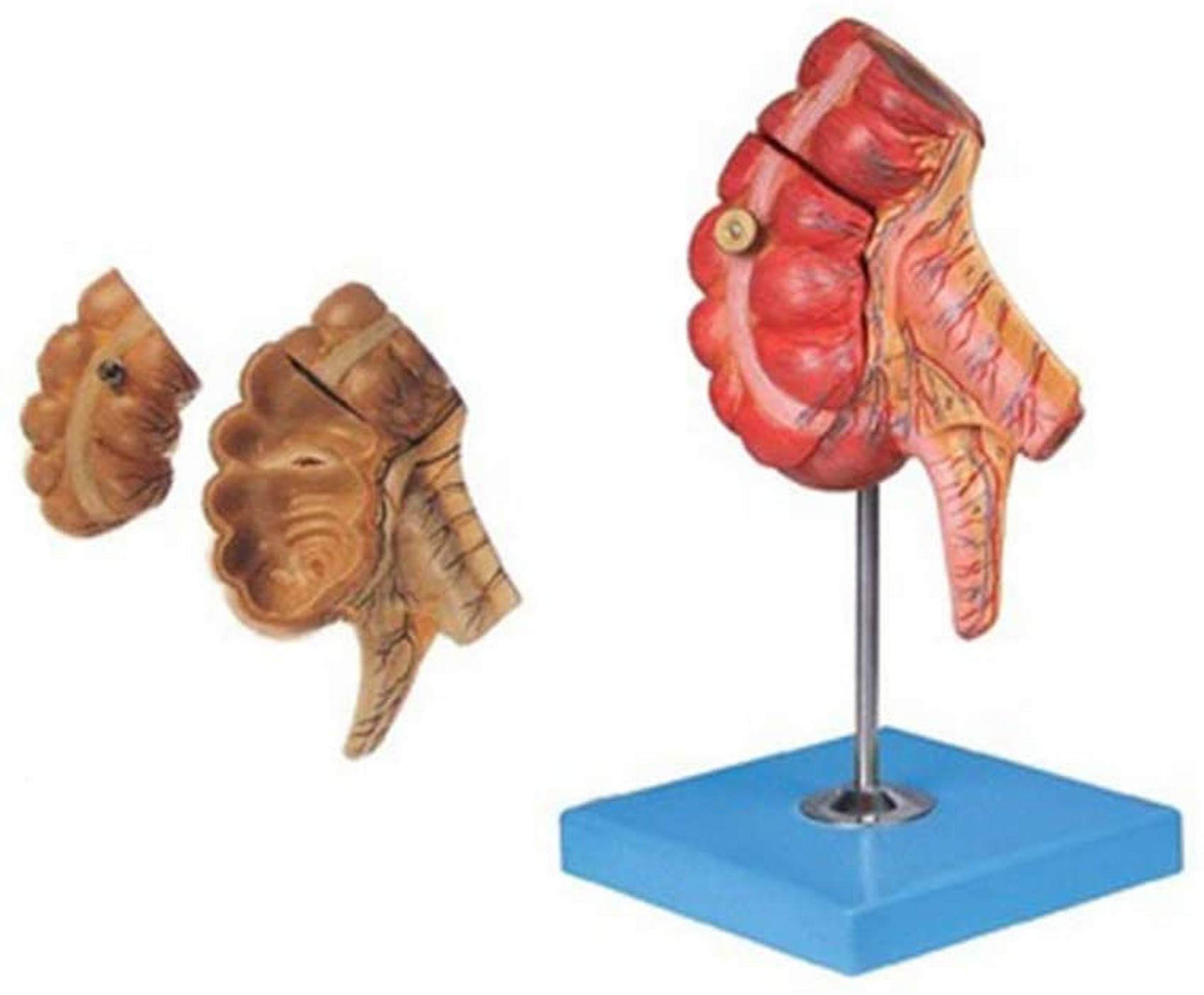 Human Appendix Location