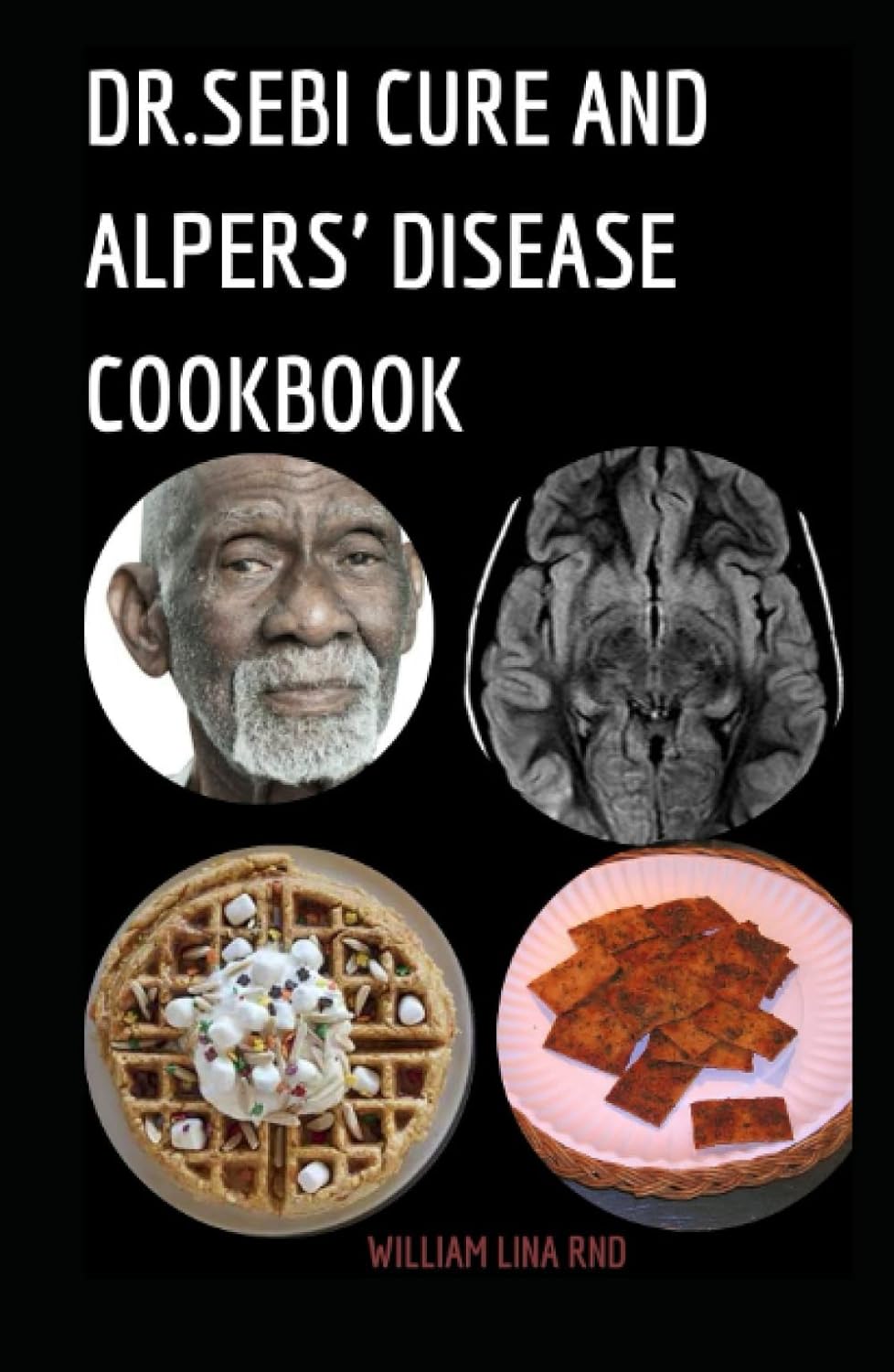 Dr.Sebi Cure And Alpers’ Disease Cookbook: Dr.Sebi Treatment For Hair ...