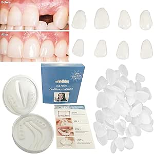 Amazon.com: Fake Tooth Repair Kits for Filling The Missing Broken Tooth ...