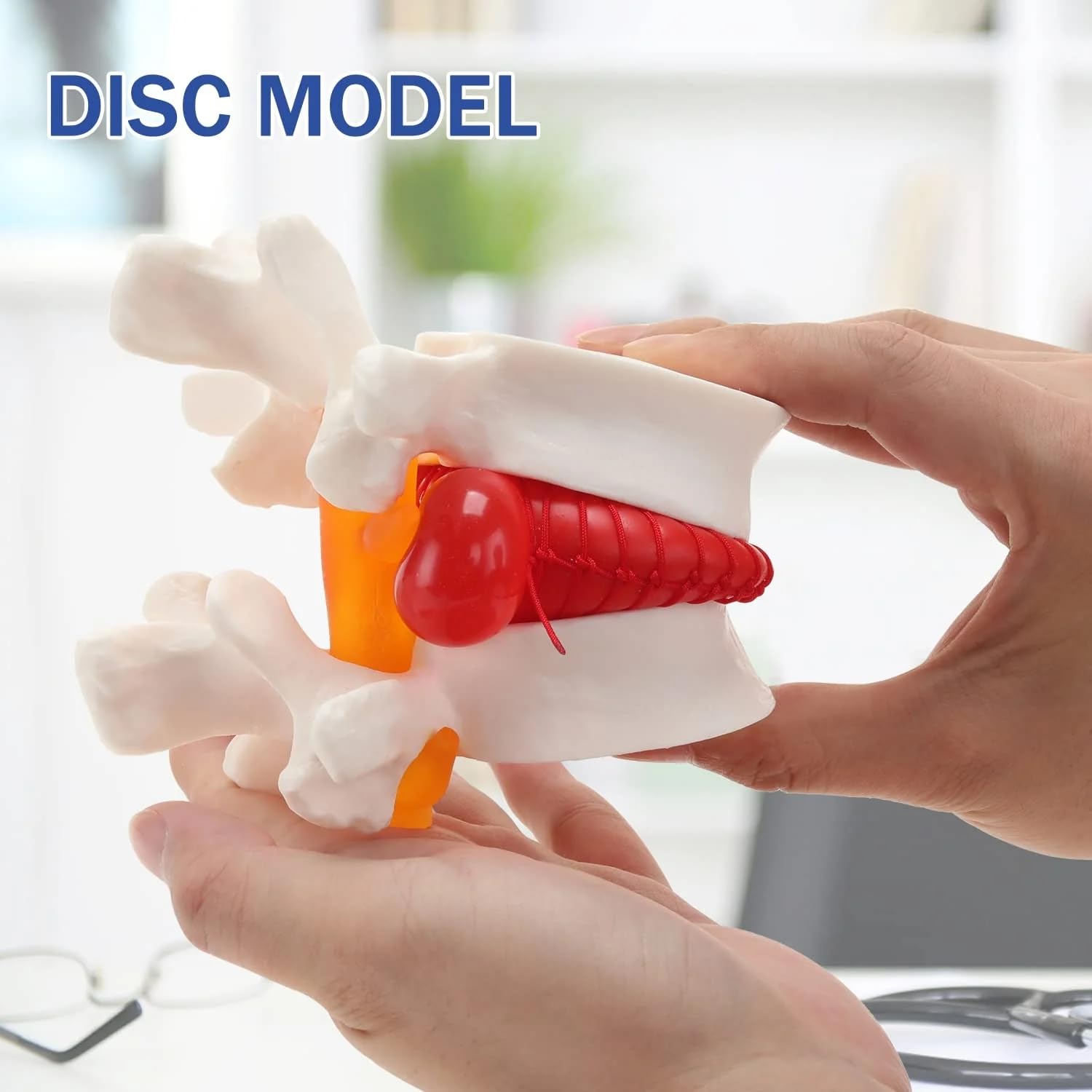 Snapklik.com : Human Anatomical Lumbar Disc Herniation Model - Lumbar ...
