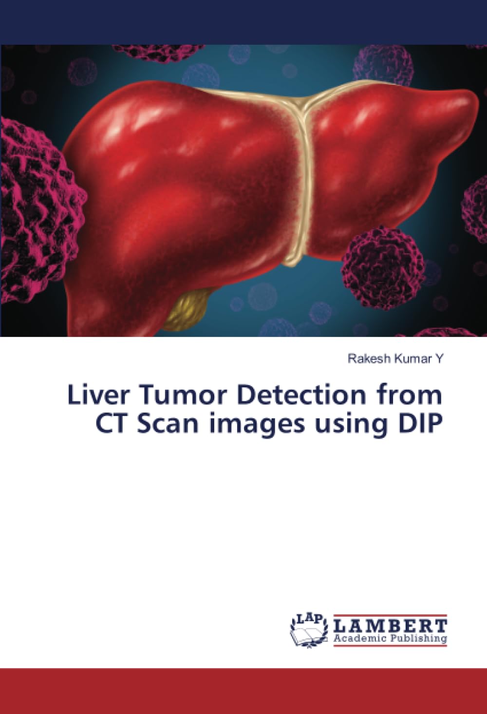 Liver Tumor Detection from CT Scan images using DIP : Amazon.in: Books