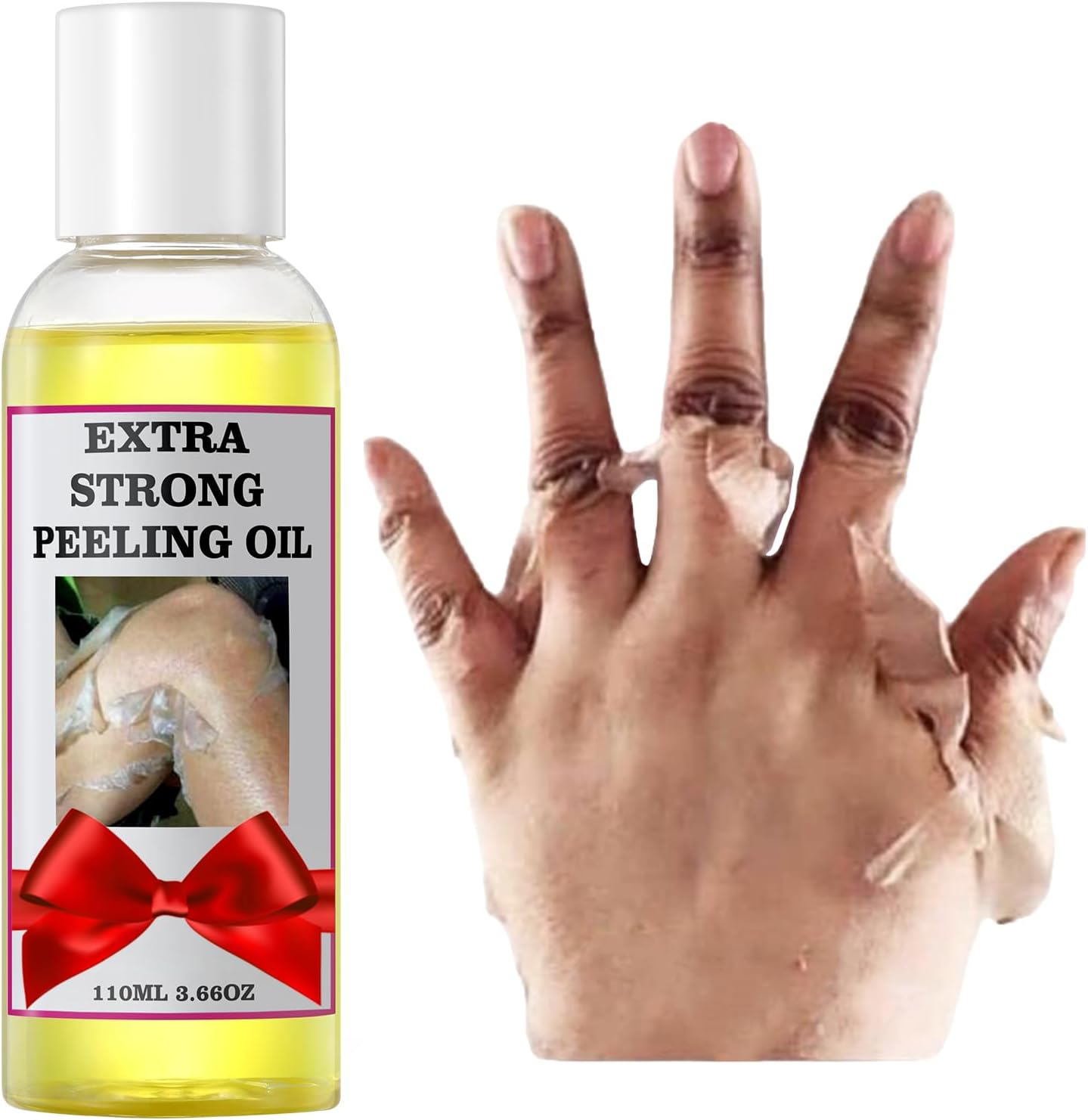 Peeling Oil Yellow Peeling Oil for Dark Skin, Peeling Oil, Extra ...