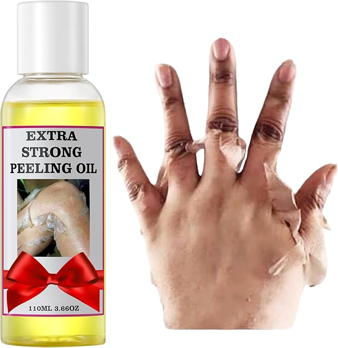 Peeling Oil Yellow Peeling Oil for Dark Skin, Peeling Oil, Extra ...