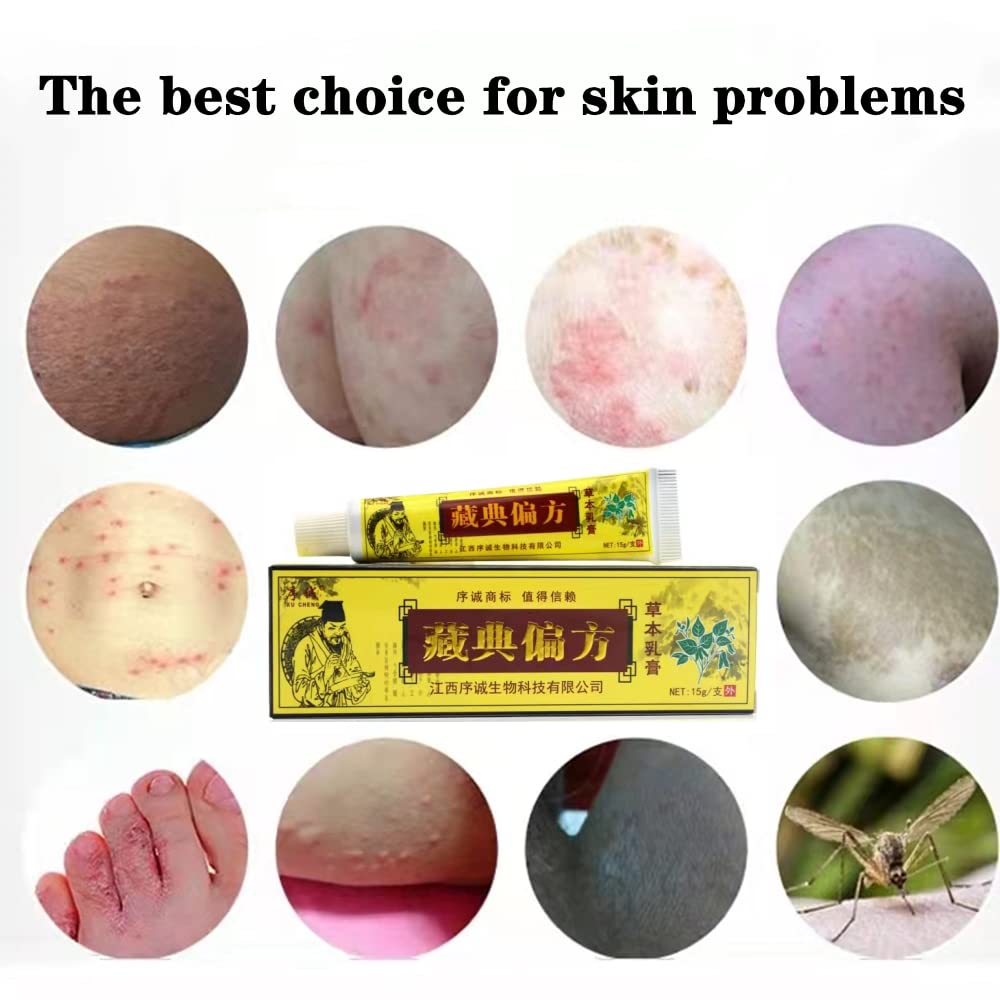 6pcsNatural Chinese Herbal Eczema Psoriasis Cream Dermatitis Pruritus ...