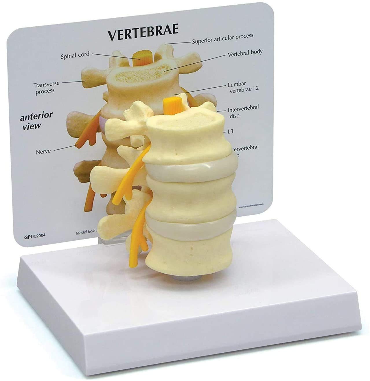 Buy Lumbar spine model 3 sections, lumbar spine disc model, teaching ...