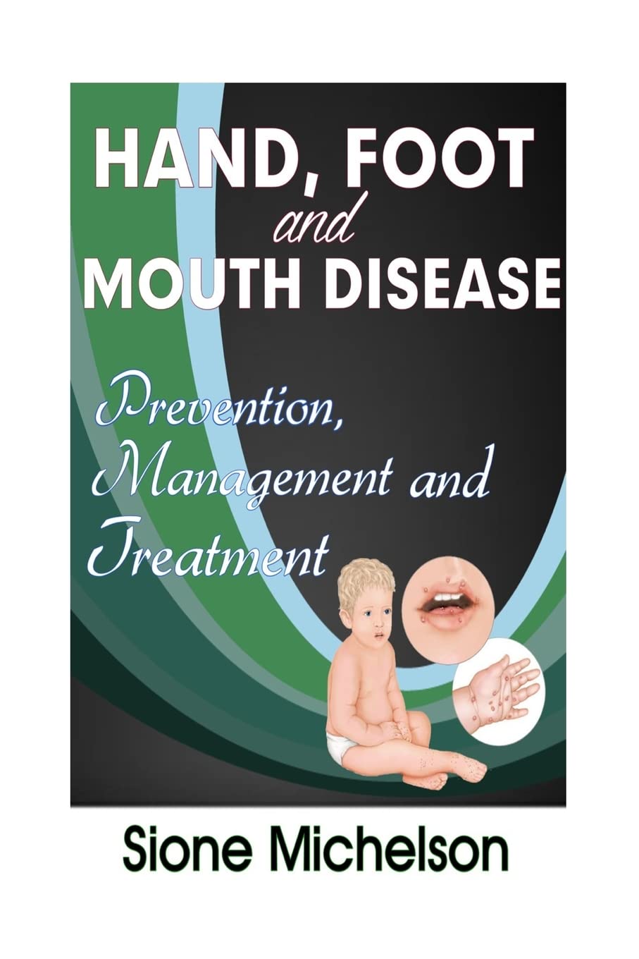 Amazon.com: Hand Foot and Mouth Disease (HFMD): Prevention, Management ...