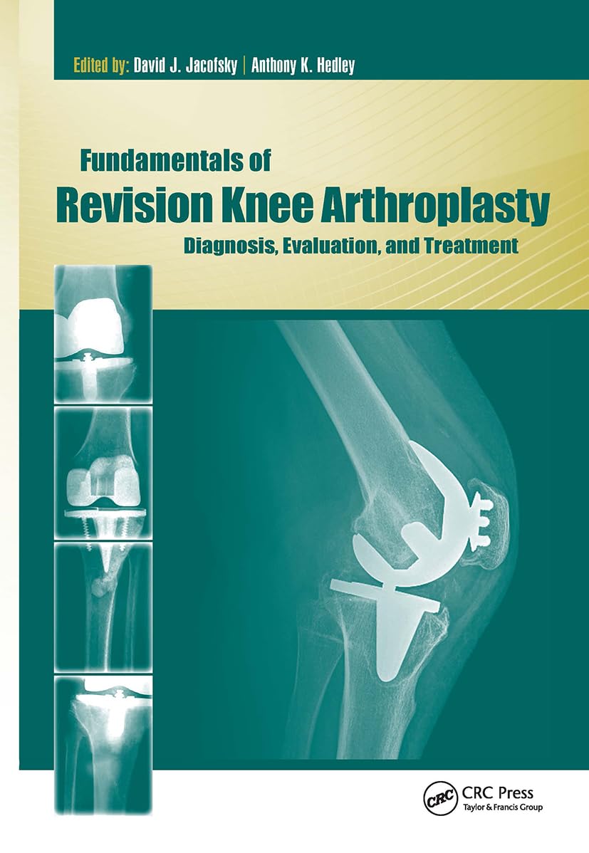 Fundamentals of Revision Knee Arthroplasty: Diagnosis, Evaluation, and ...