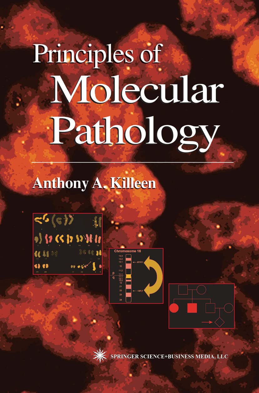 Amazon.com: Principles of Molecular Pathology eBook : Killeen, Anthony ...