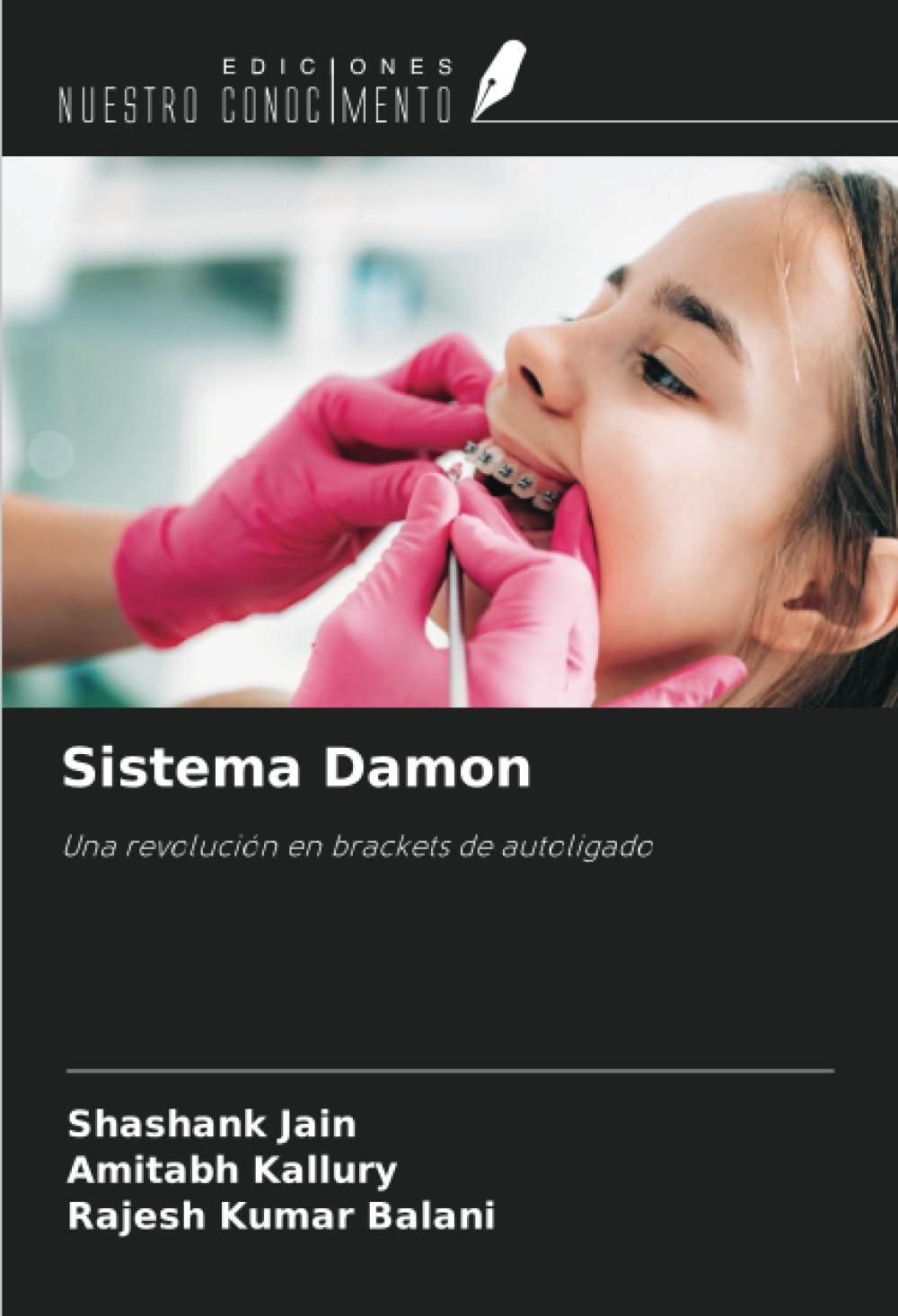 Amazon | Sistema Damon: Una revolución en brackets de autoligado | Jain, Shashank, Kallury ...