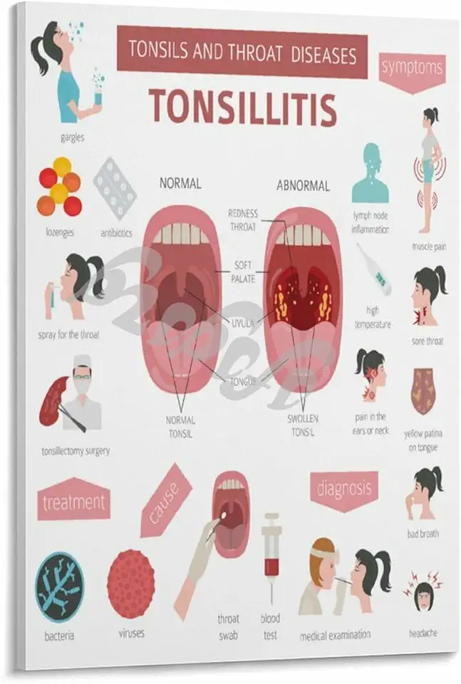 What Do Your Tonsils Look Like And Why It Matters | MedShun